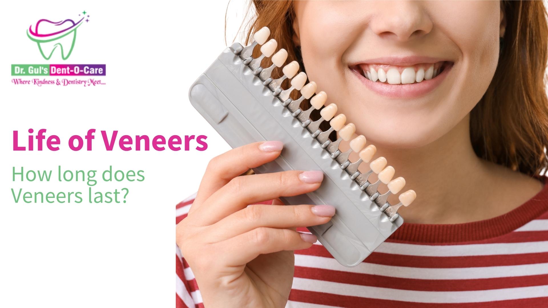 How long do dental veneers last if cared for? - Life of Dental Veneers