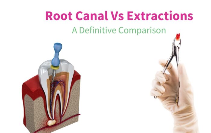 Blogs - DR GUL'S DENTAL CLINIC NOIDA