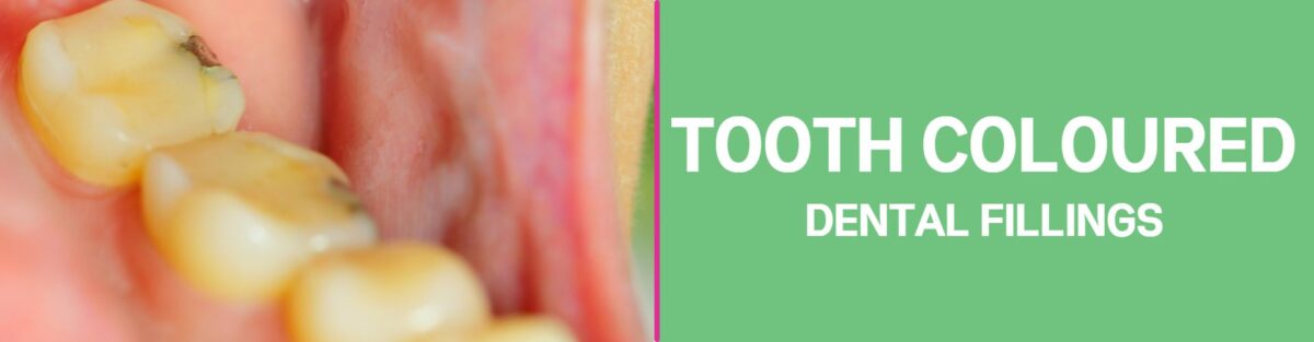Tooth Colored Filling In Noida - DR GUL'S DENTAL CLINIC NOIDA