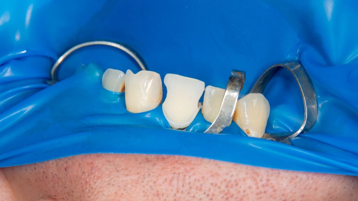 Dental Tourism in Noida, India | Dr Gul's Dental Clinic