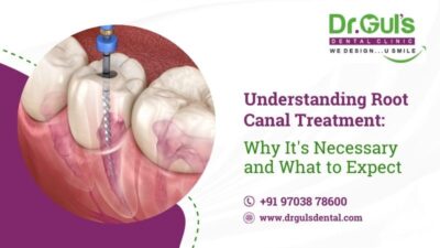 Root Canal Treatment: Signs, Procedure & Recovery Guide