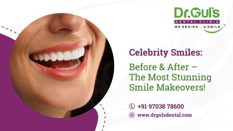 Celebrity Smiles: Before & After – The Most Stunning Smile Makeovers!
